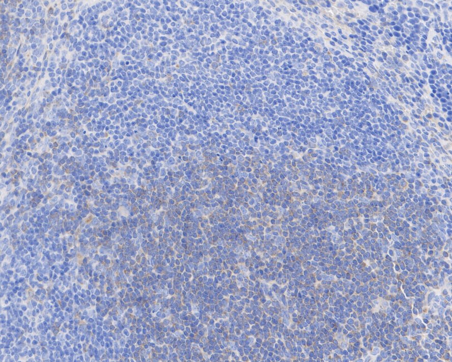 推动生命科学发展，优质单抗，多抗，蛋白，试剂盒| HUABIO华安生物